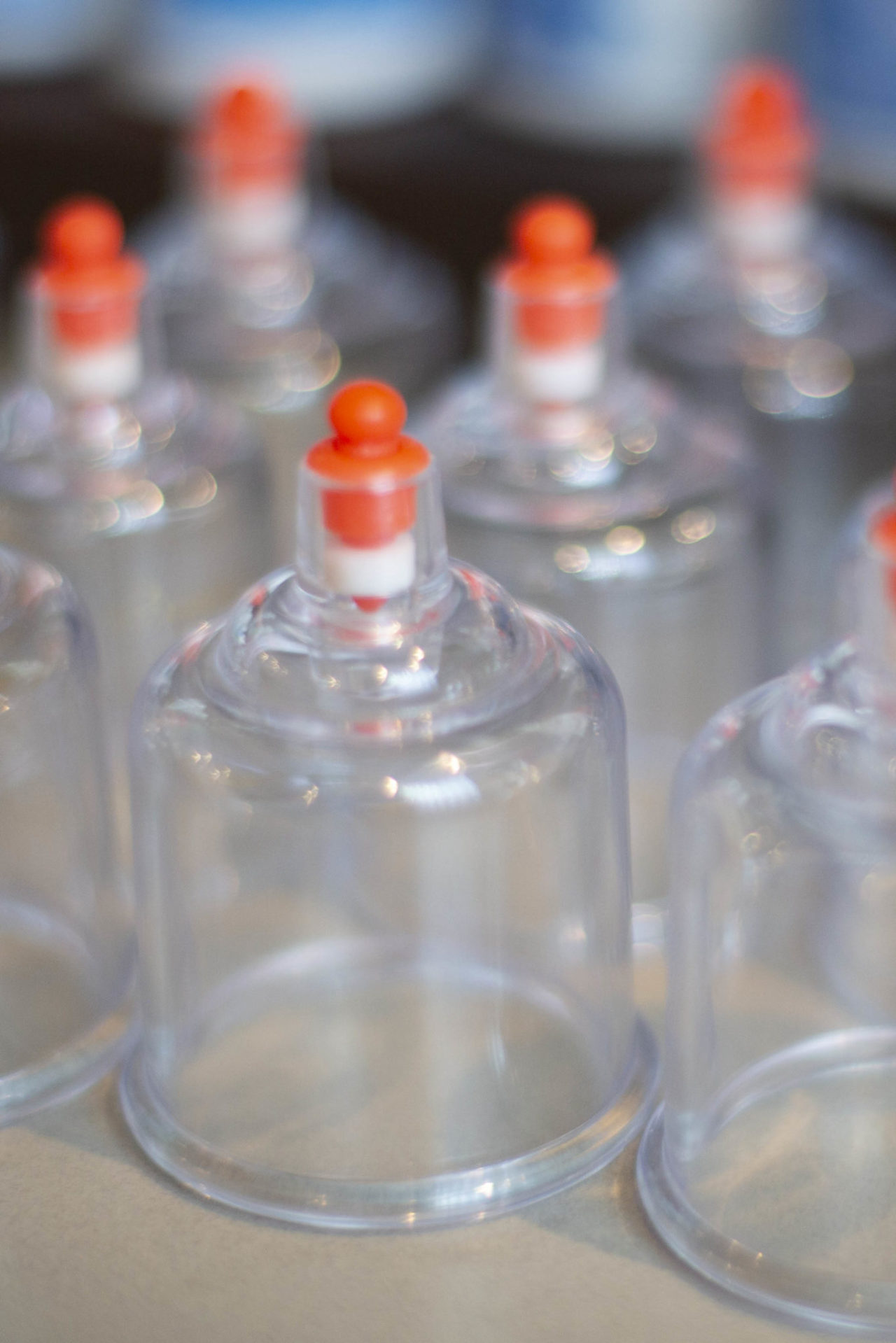 Acupuncture at the Boulder Mandala Integrative Medicine Clinic ...